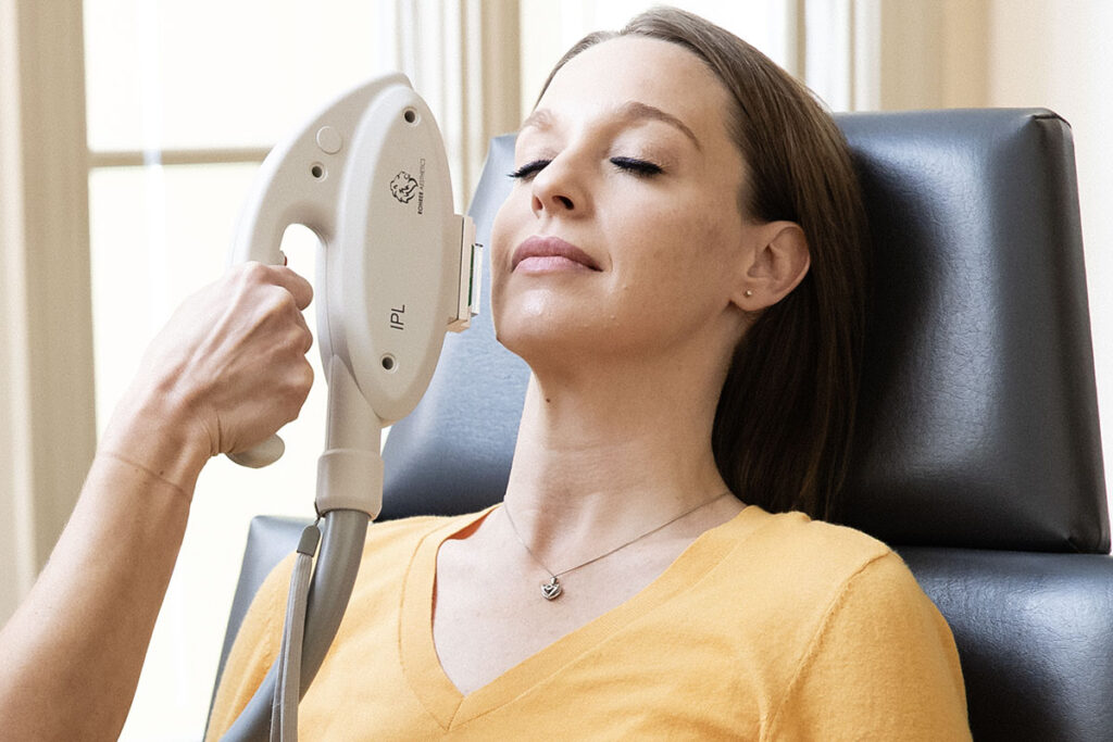 IPL in Gulf Shores | McCollough Plastic Surgery